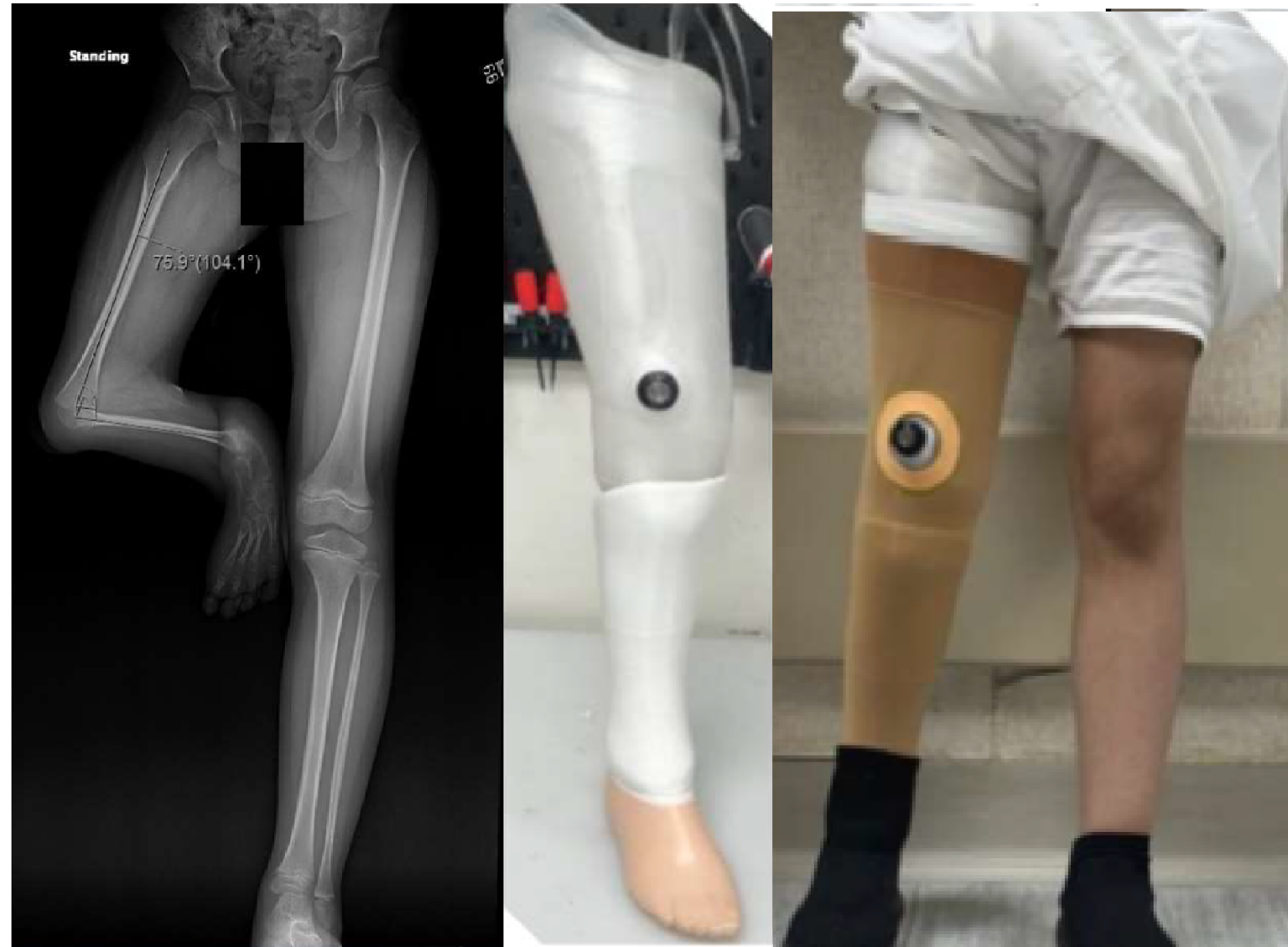 OANDP.PK – by Orthotics Prosthetics Pakistan